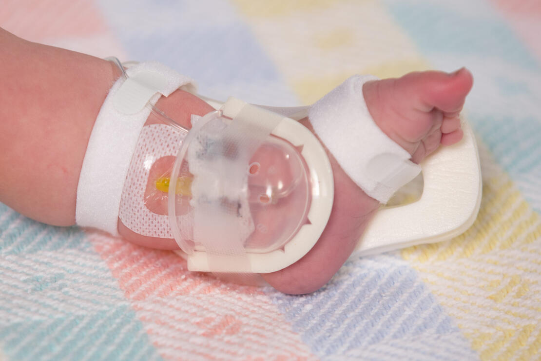 Pediatric Ankle Joint IV Stabilizer, TLC Foot Splint | I.V. House