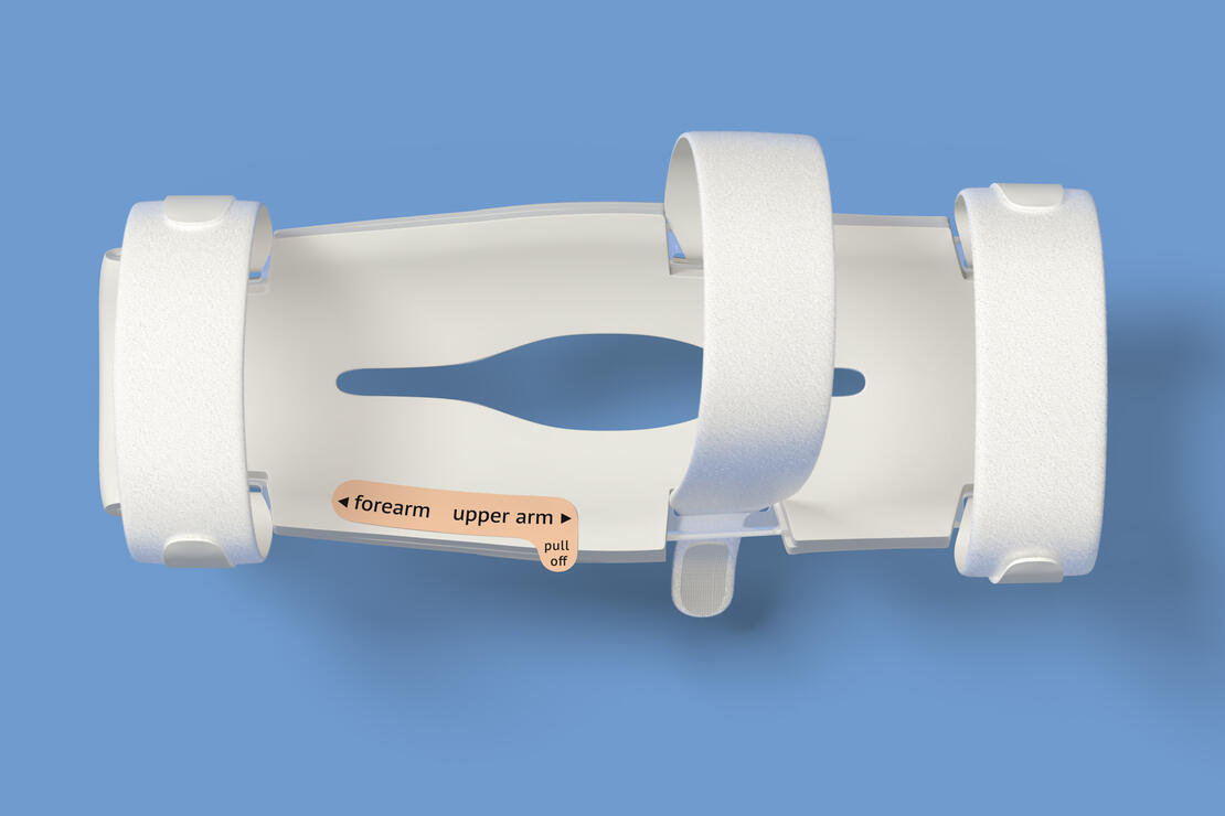 TLC Elbow Splints, Elbow IV Stabilization Device | I.V. House