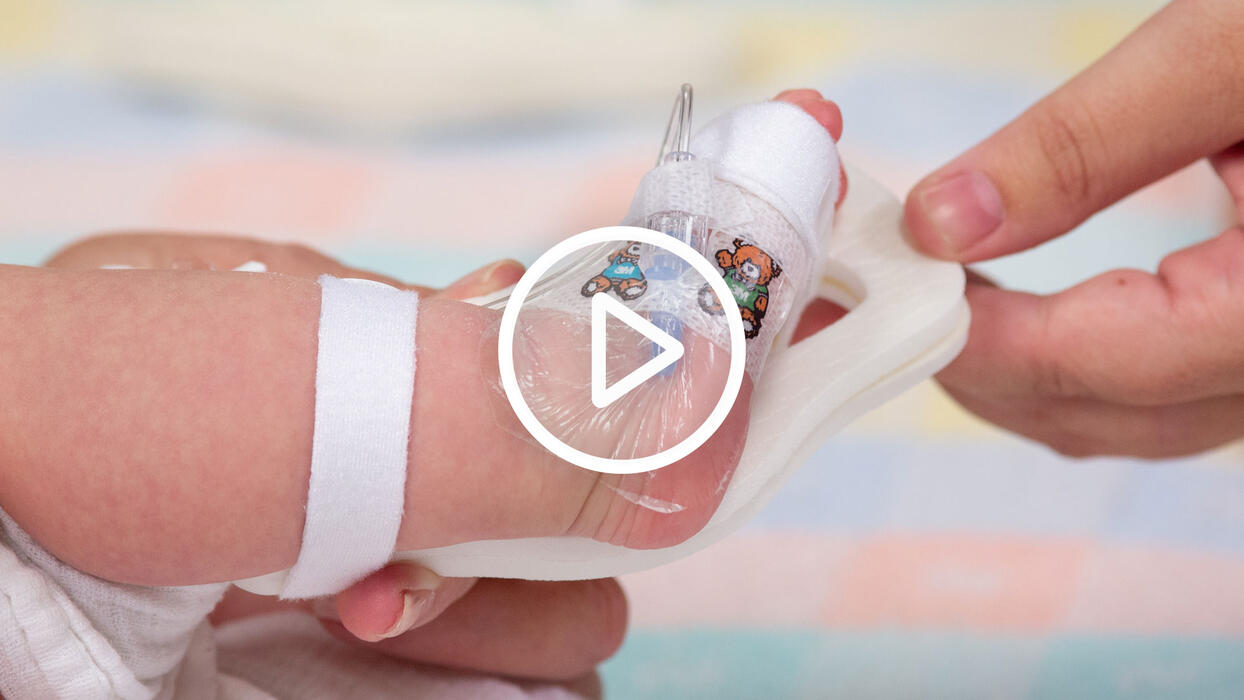 TLC Foot Splint, Size XS for Newborns